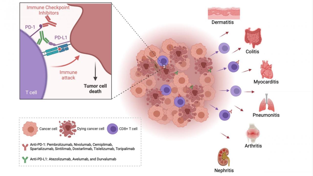 Determine the Mechanism Behind Immune-Related Adverse Events Associated with Checkpoint ...